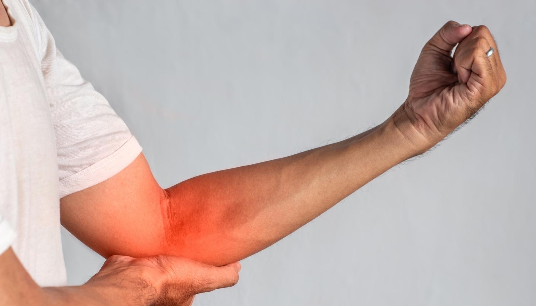 Tendinitis del Brazo 》 👉 Tratamiento integral para ti